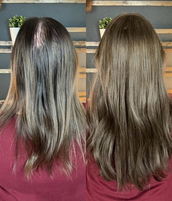 7.5” X 7.5” UPGRADE AURA SKIN TOP HUMAN HAIR TOPPER | WITH LAYERS – Roma